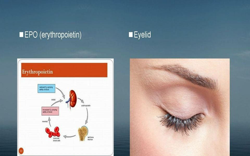 专业医学英语术语单词笔记本——今天讲E