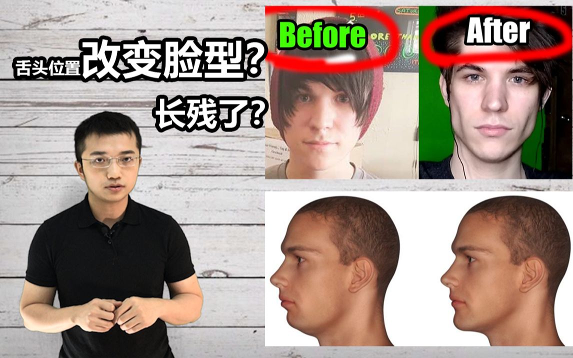 舌头的位置会改变脸型?口呼吸的模式如何纠正?