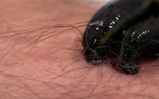 水蛭会分泌凝血酶天然抑制剂