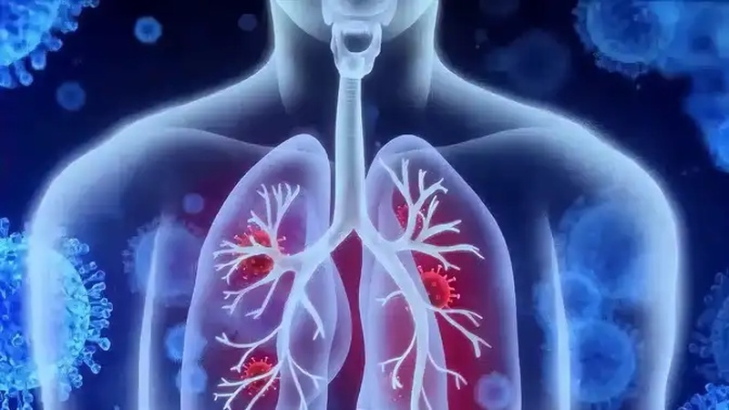 呼吸道传染病流行下降,国家卫健委发布最新监测数据