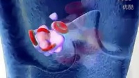 深静脉血栓栓塞的三维医学动画-想要更多视频请关注“小琳皓影音”