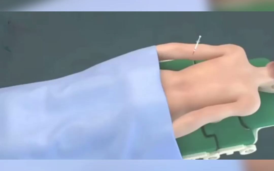 3D动画演示腰间盘突出微创手术