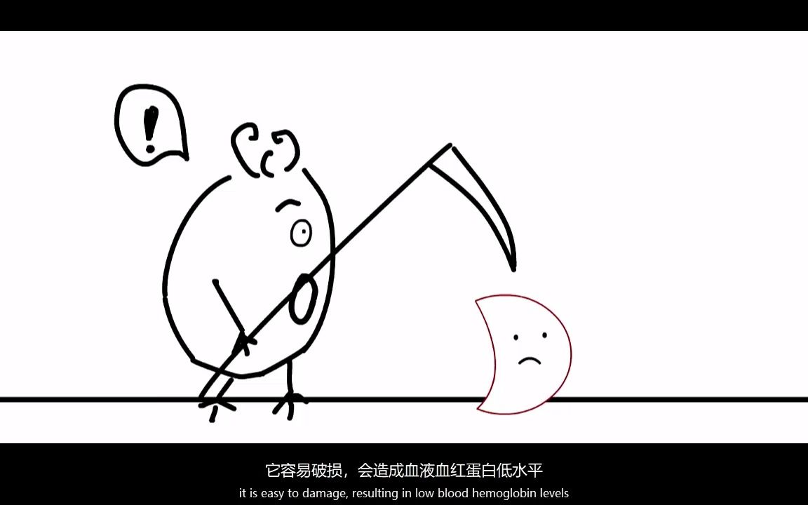 Flash-基因突变动画-镰刀型红细胞