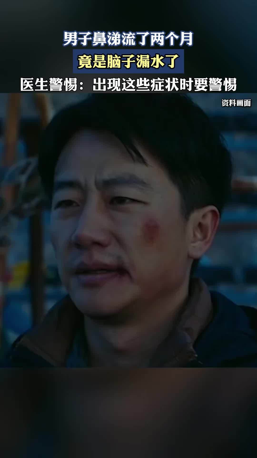 男子鼻涕流了两个月,竟是脑子漏水了。