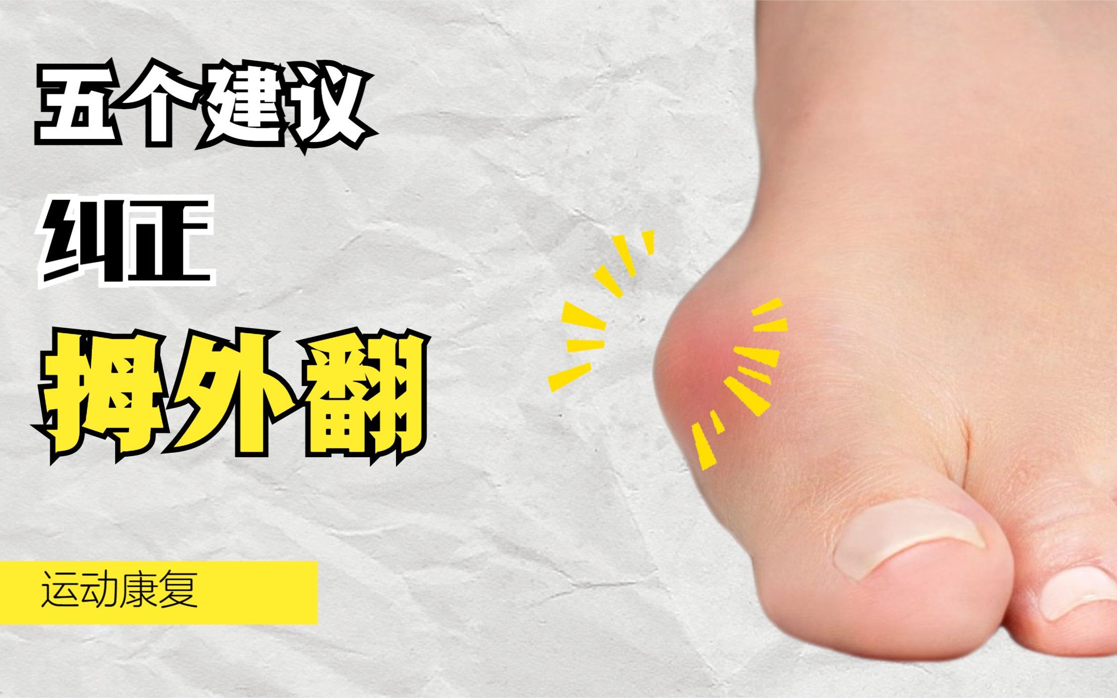 大脚趾关节疼?总是起茧?五个建议,纠正拇外翻,缓解拇囊炎