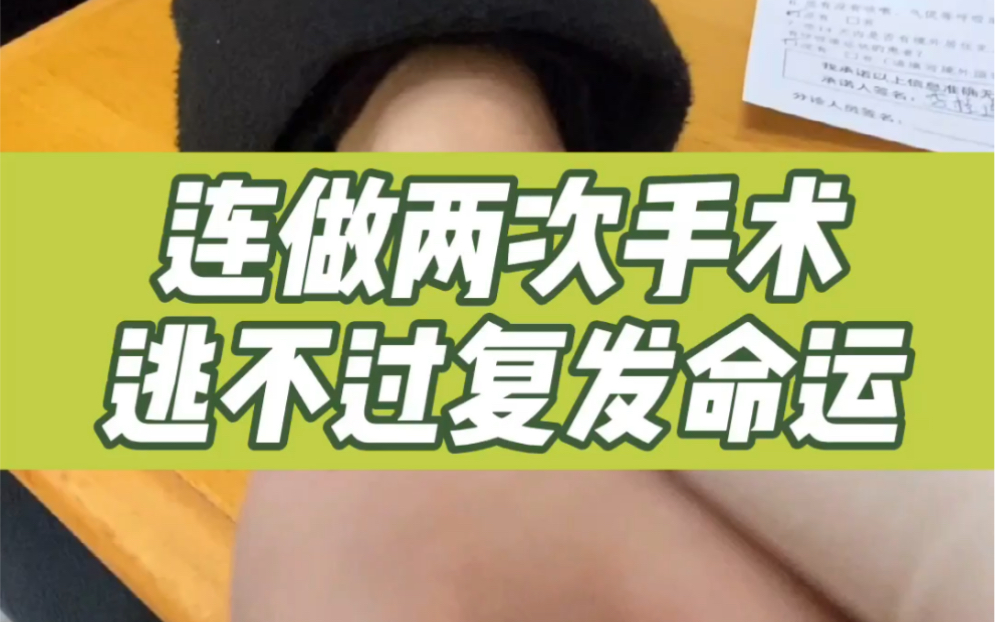 手术后复发的腱鞘囊肿。