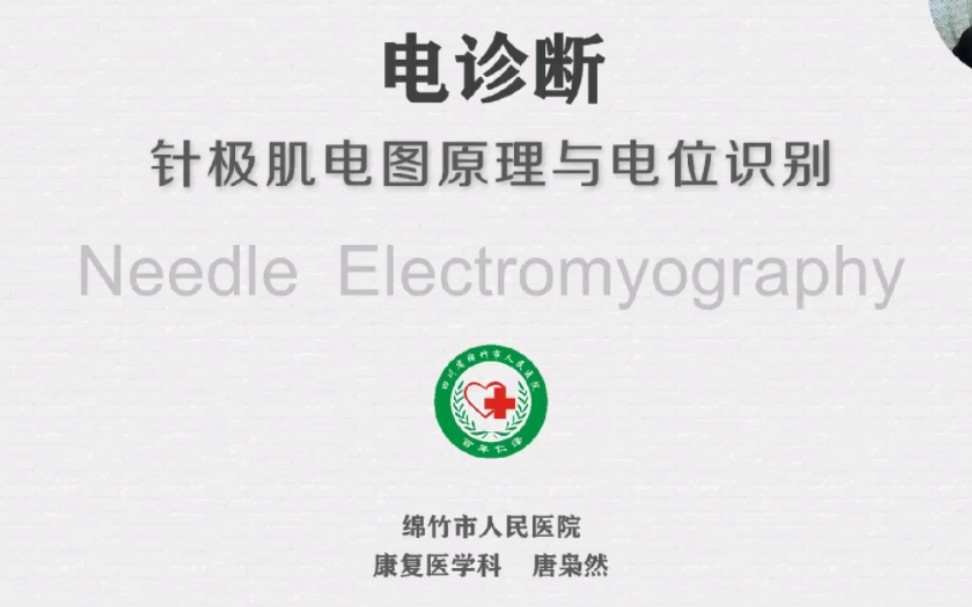 肌电图自发电位的识别