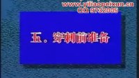 17分类-肝癌的动脉灌注化疗及栓塞疗法【请看简介】