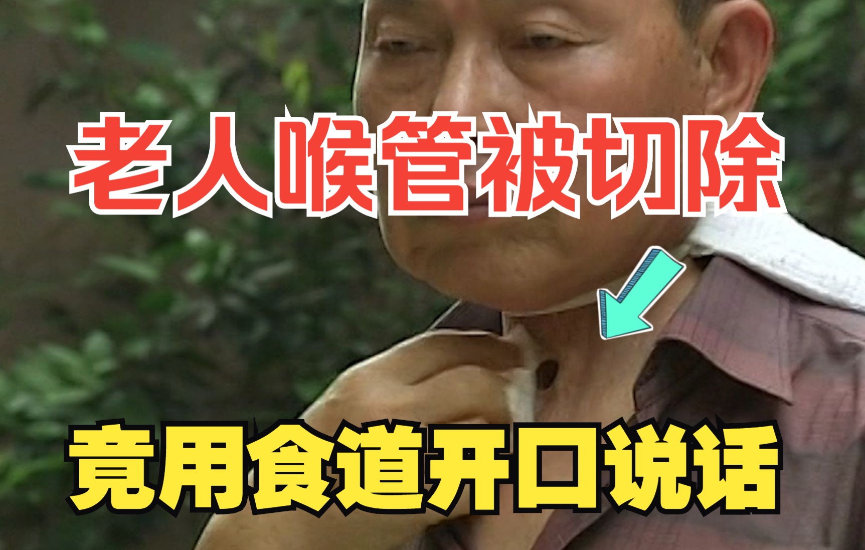老人喉管和声带被切除,竟用食道开口说话