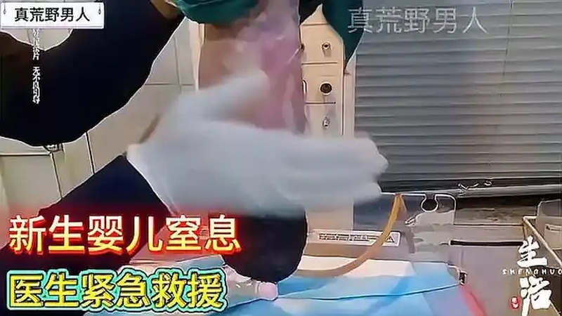 新生婴儿窒息,医生紧急救援