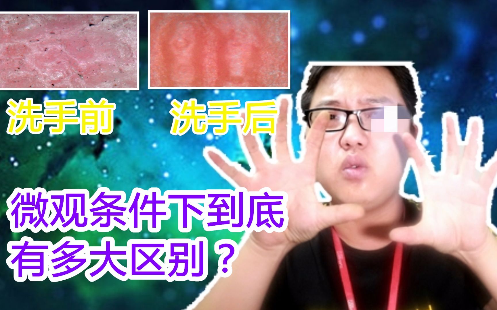 手在清洗前后到底有多大区别,显微镜下观看后,网友:像垃圾场