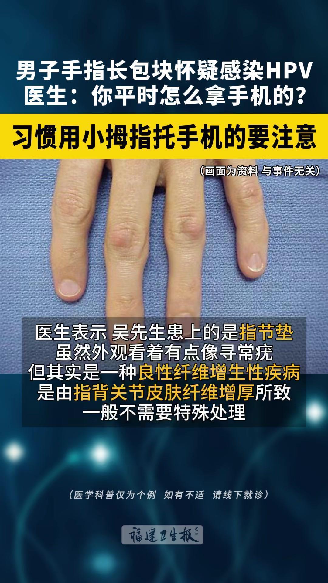 ...你平时怎么拿#手机的?习惯用小拇指托手机的要注意#玩手机#新闻