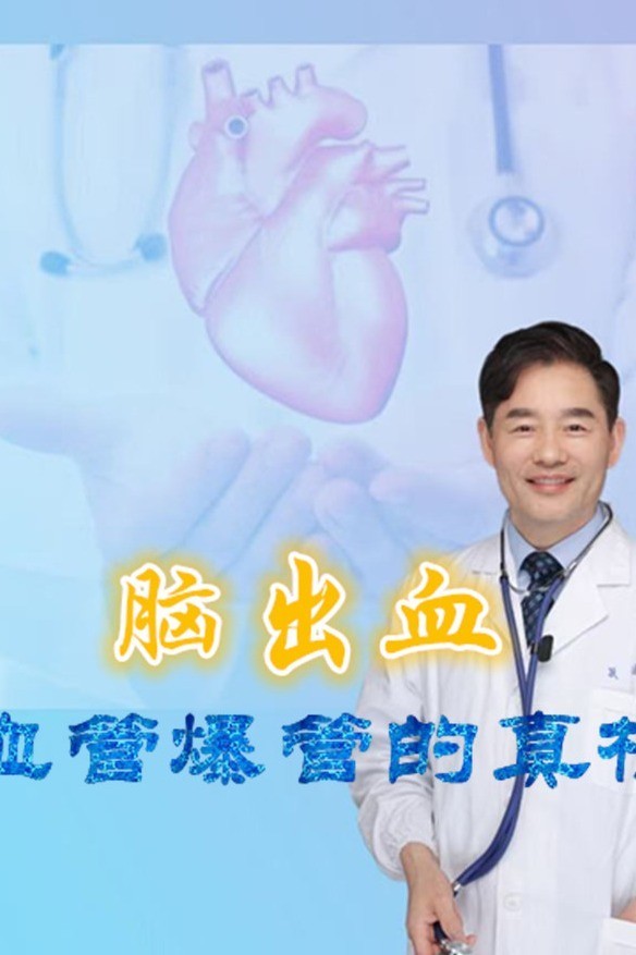脑出血:血管"爆管"的真相