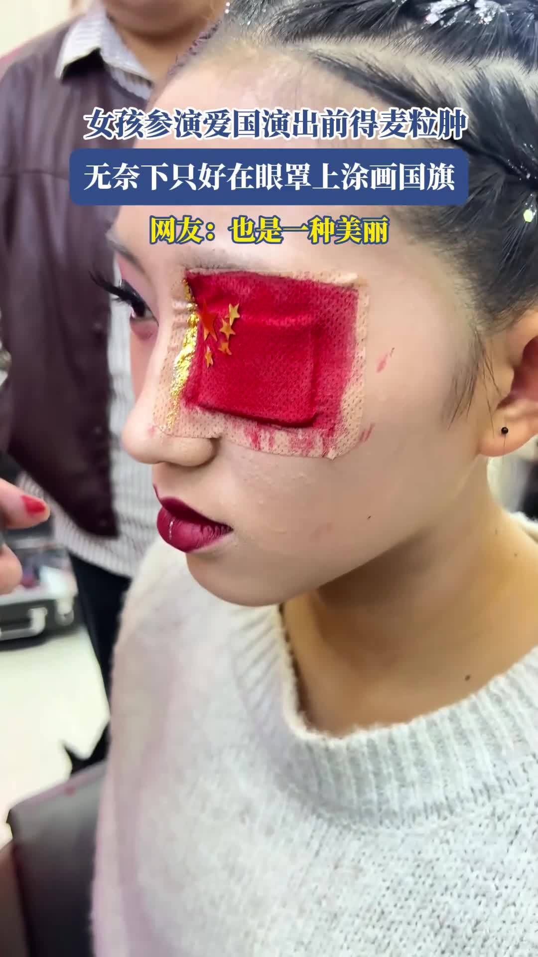 女孩参演爱国演出前得麦粒肿,无奈下只好在眼罩上涂画国旗