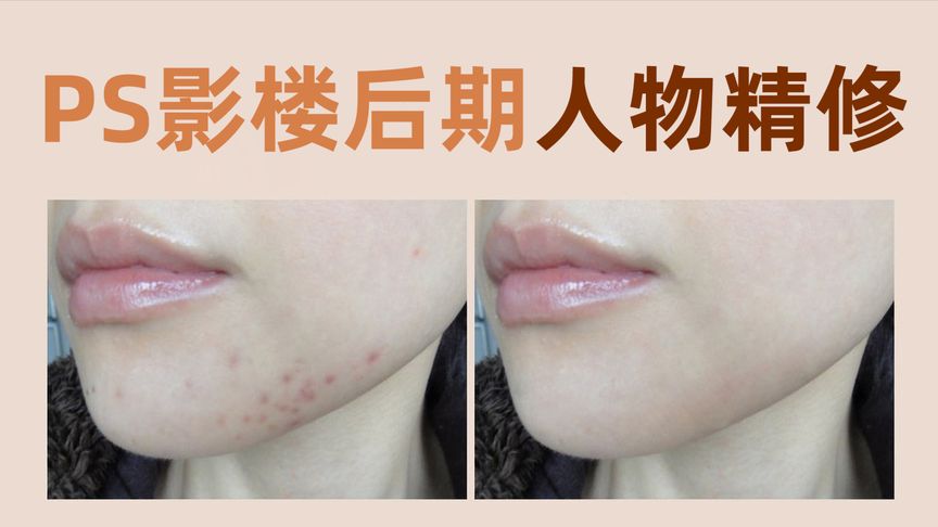 【PS影楼后期】人物精修修除青春痘
