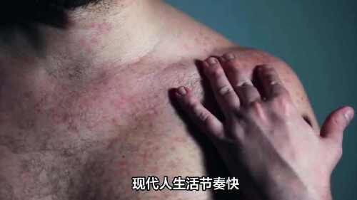 土茯苓竟有这些神奇功效?医生不敢说的秘密全曝光!