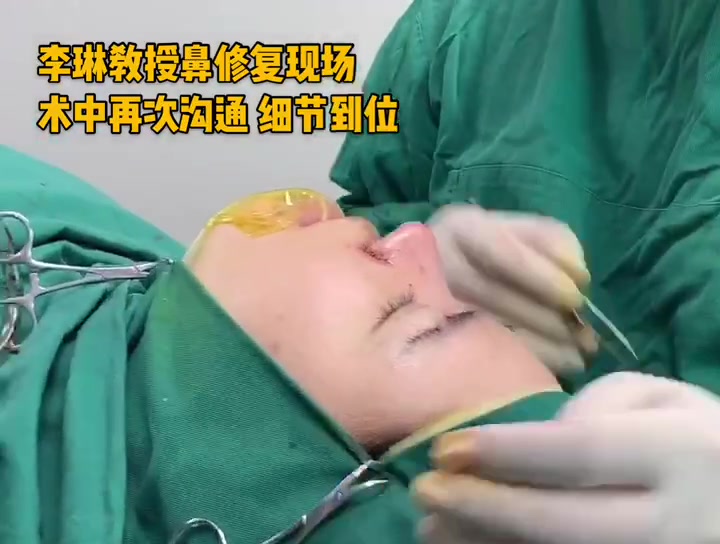 鼻修复术中沟通真的很重要!
