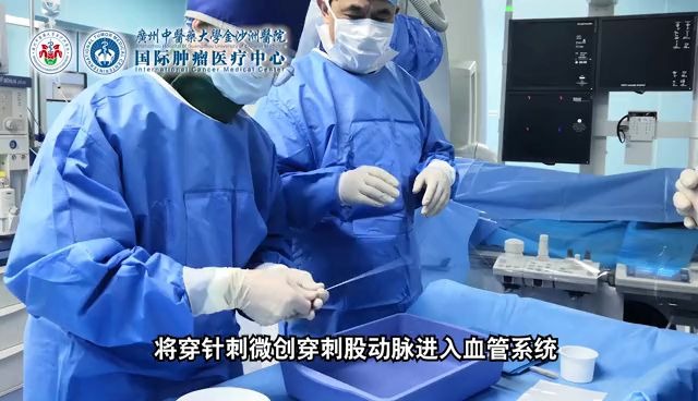 DSA可视动脉介入灌注栓塞术,癌细胞的“精准”克星!不开刀、痛苦小...