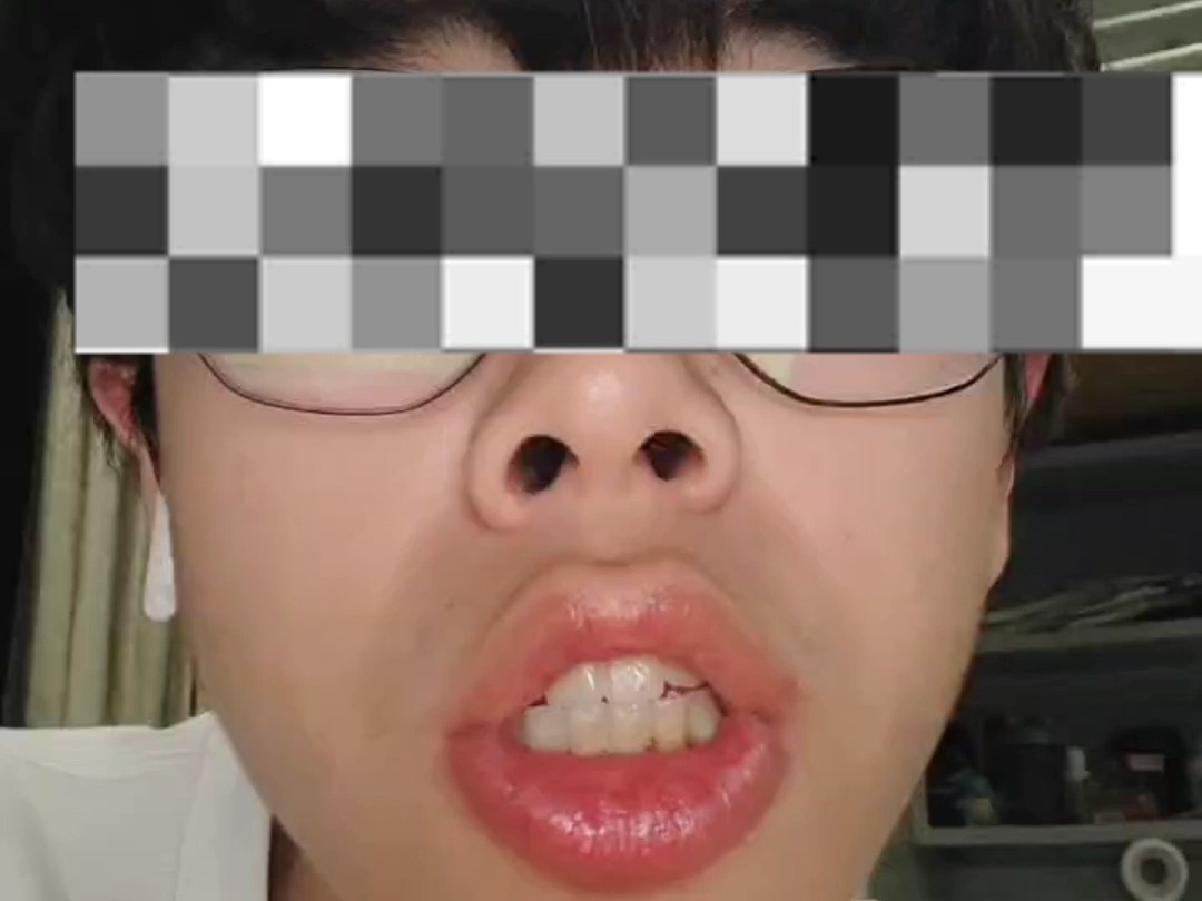 柜式楼梯(23信二,1211)