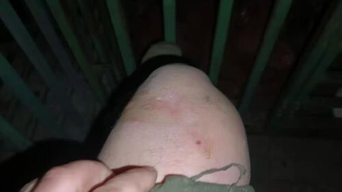 狗打架还是离远点比较好