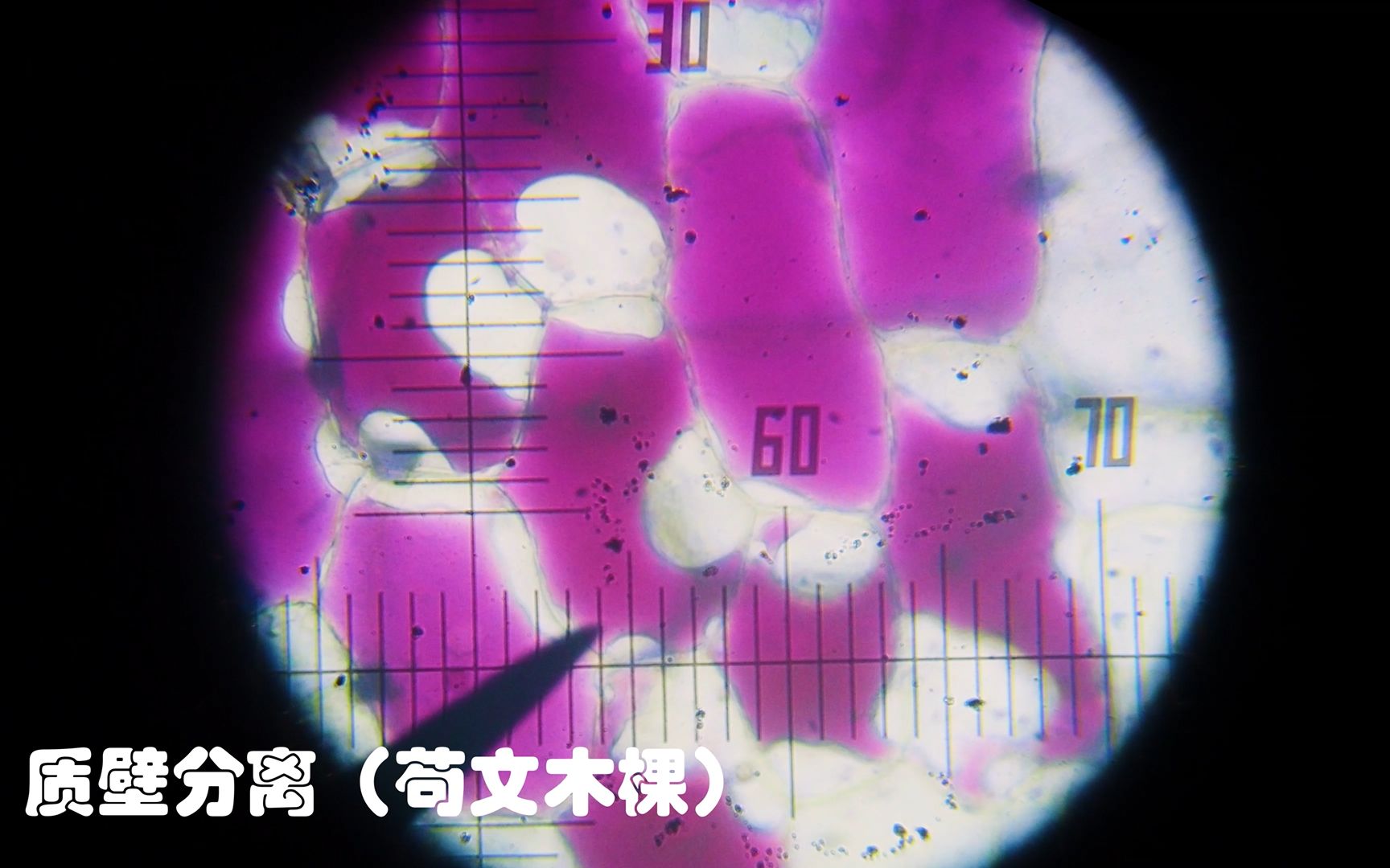 洋葱质壁分离(苟文木棵)