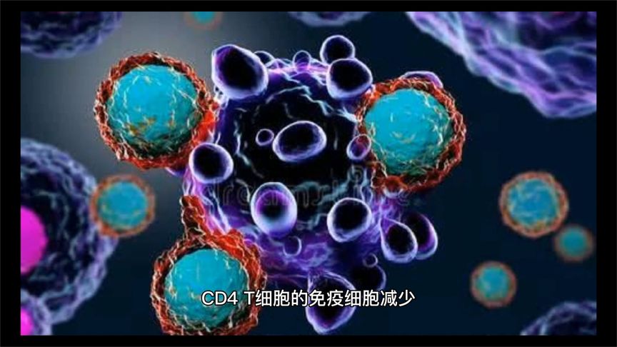 #HIV病毒变异#毒性更强#更具传染性#Omicron#新冠#新冠遇上艾滋