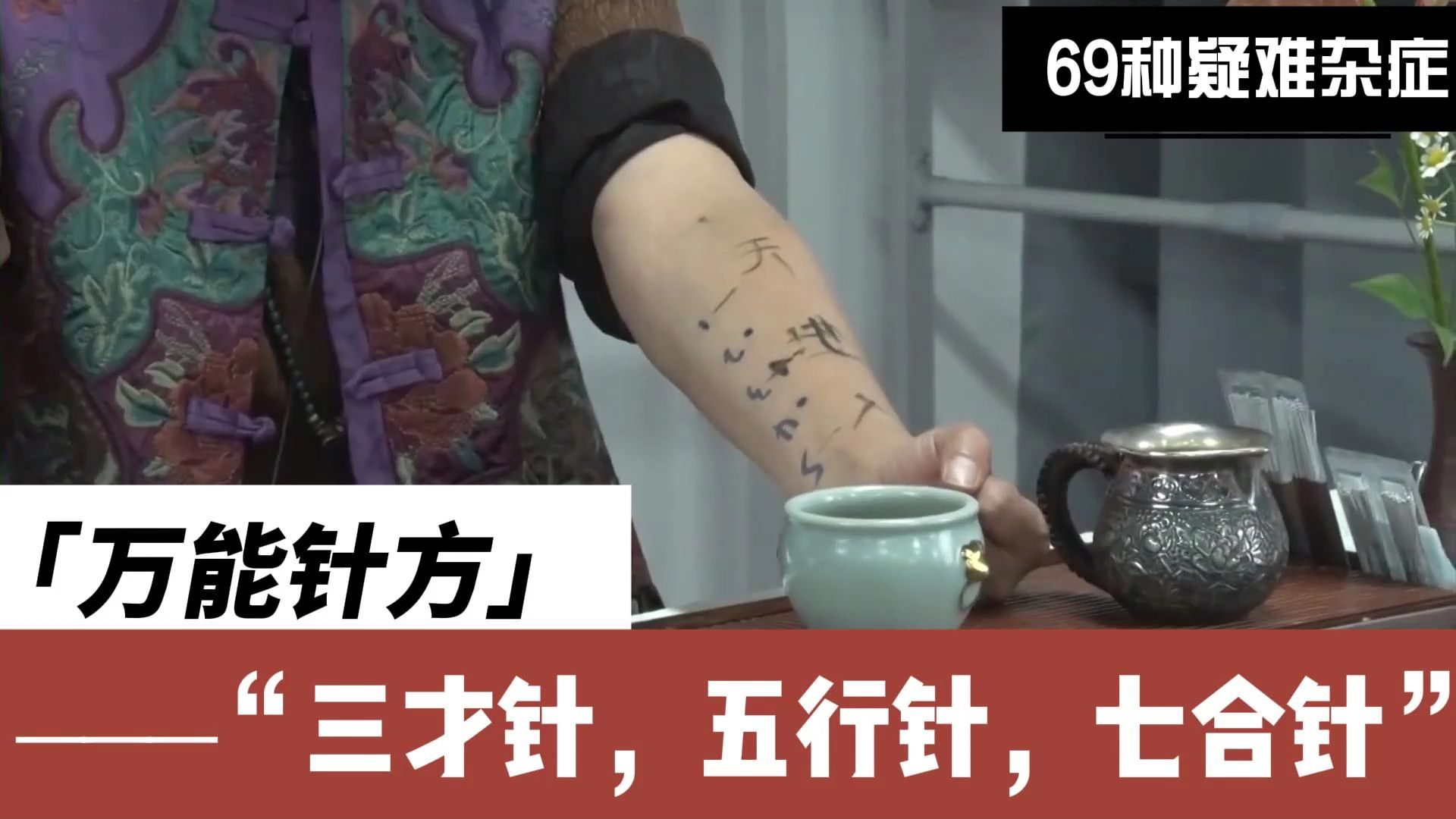 69种疑难杂症【舒卿】中医针灸秘籍!三才针、五行针、七合针,舒卿带...