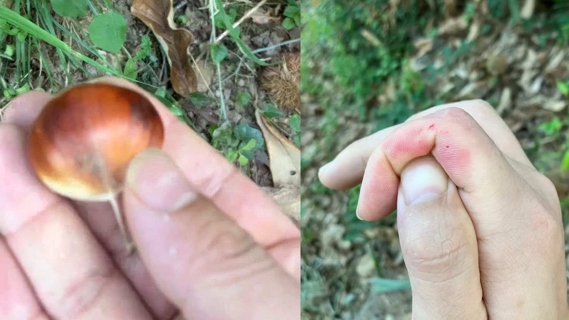 男子路过板栗林,捡板栗拍视频突然被砸,一声尖叫手指瞬间红肿
