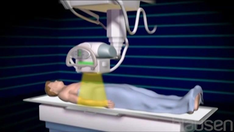 医学3D动画演示:X射线是如何产生的?