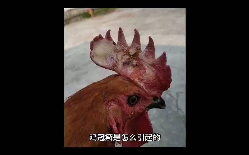 鸡冠癣是怎么引起的 鸡癣怎么治疗 鸡冠长癣用什么治 鸡冠癣的症状 ...