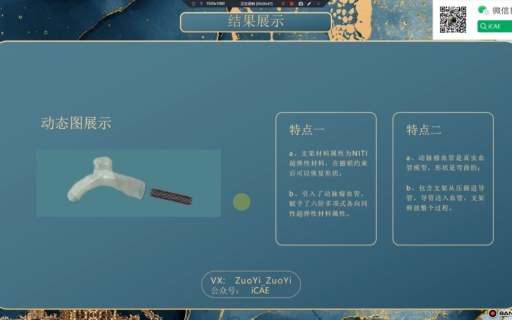 Abaqus-NiTi自扩张支架置入动脉瘤弯曲血管仿真
