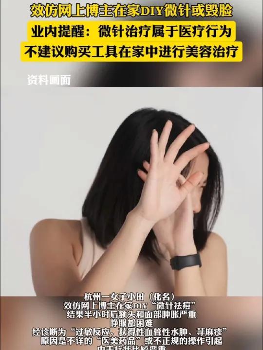 ...微针或毁脸,业内提醒:不建议购买工具在家中进行美容治疗(半两财经)