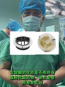 《机械瓣与生物瓣的区别》#医学科普 #科普健康知识 #健康 #涨知识 #...
