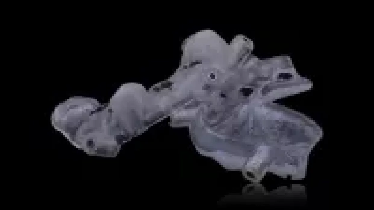 数字化导板种植