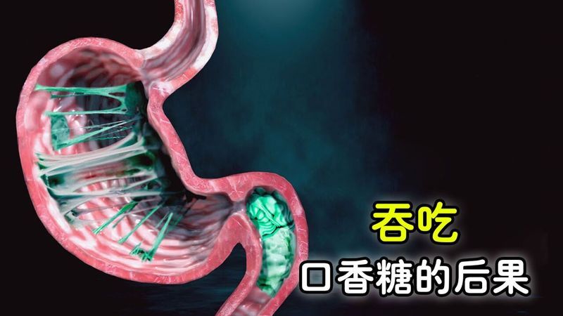 国外小伙吞吃口香糖挑战,医生检查后:我尽力吧!
