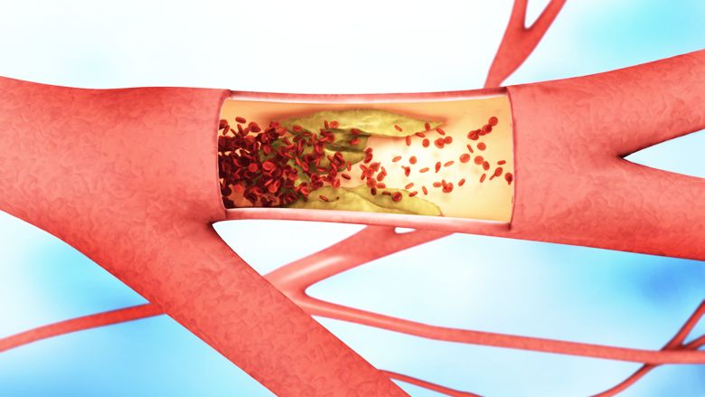 检查动脉粥样硬化的手段有哪些?