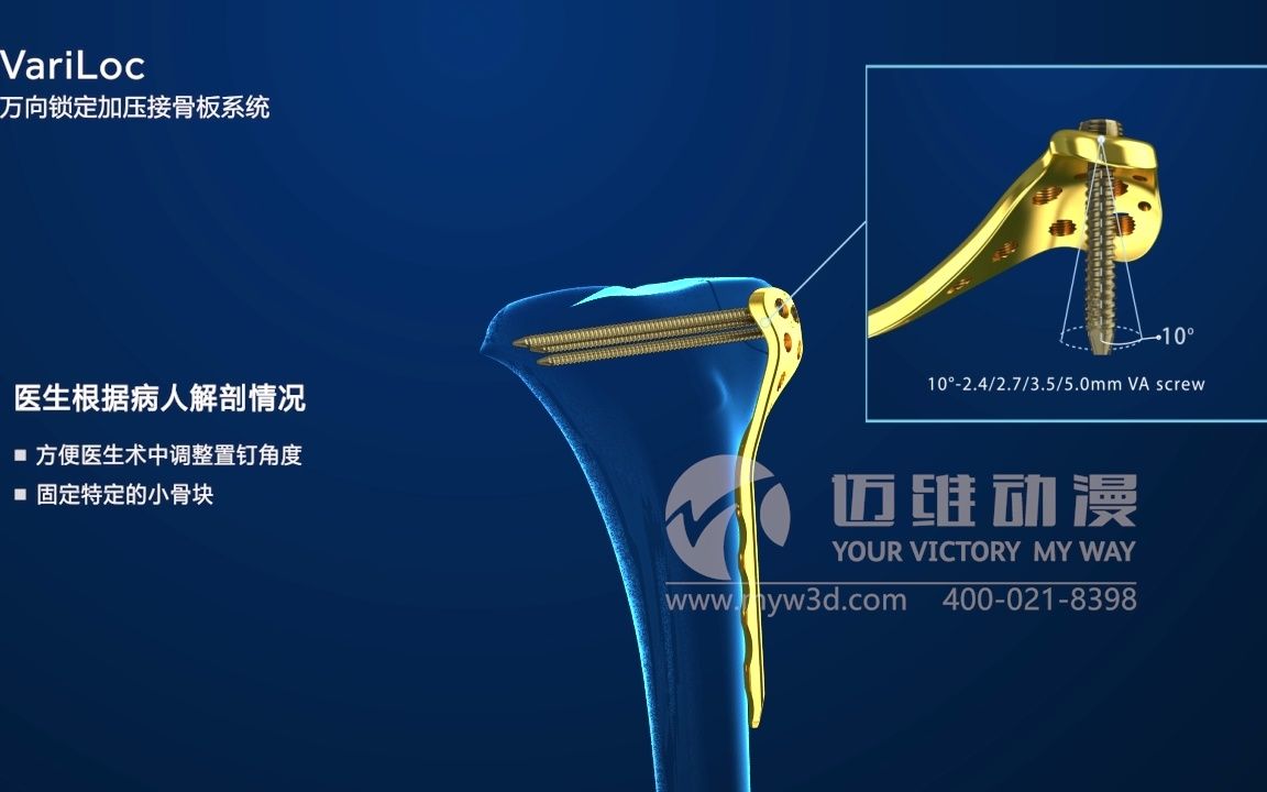 医疗器械产品夹骨锁定板动画展示-工业三维动画制作公司