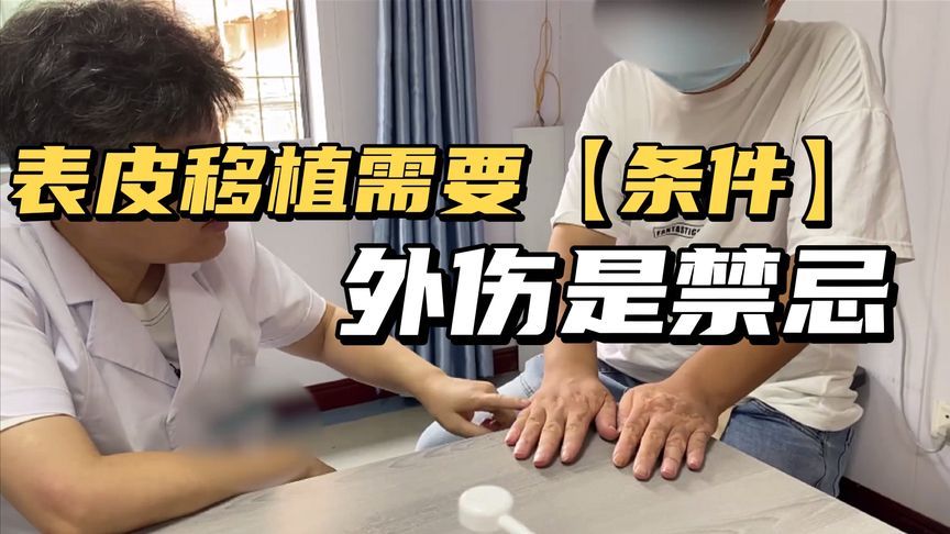 【手部白癜风要刮皮?】表皮移植需要几个【条件】,外伤是禁忌