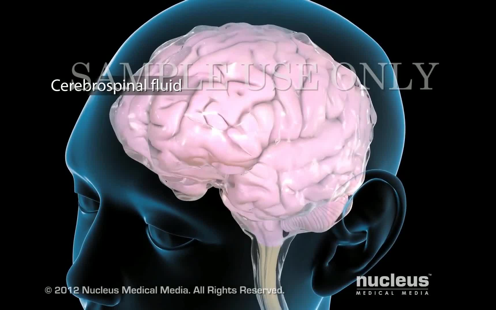 【3D医学动画】病毒性脑膜炎(中英双字幕)