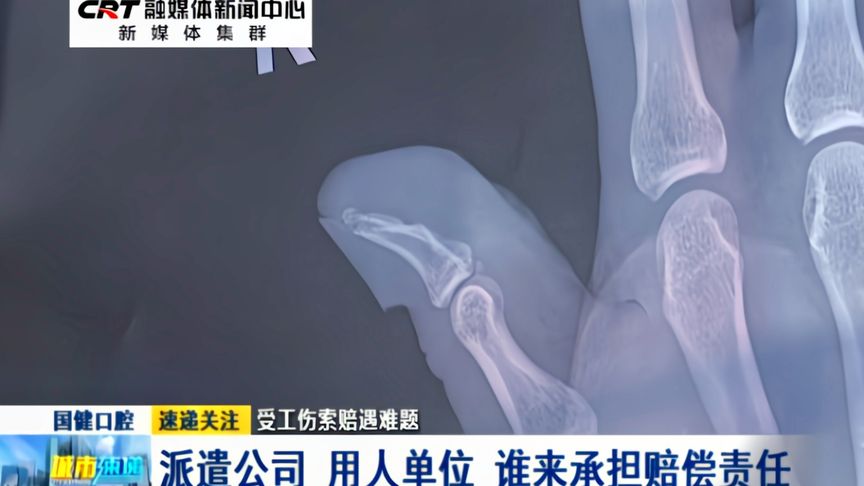 受工伤索赔遇难题:派遣公司 用人单位 谁来承担赔偿责任