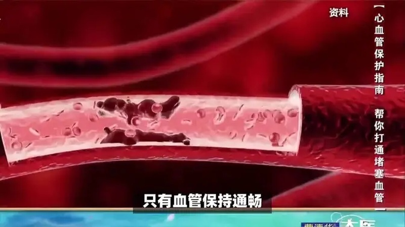血管堵塞时,头部会有4个变化,需留心观察,防止造成严重危害