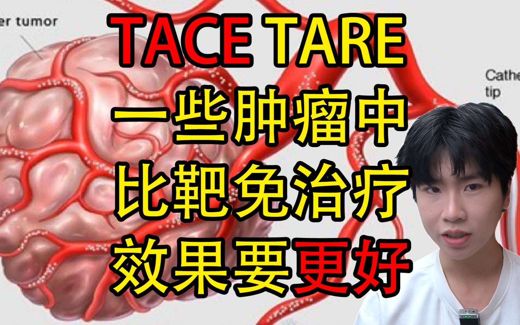 ...癌症的方法,究竟是何方神圣?带你简单了解一下什么是TARE和TACE