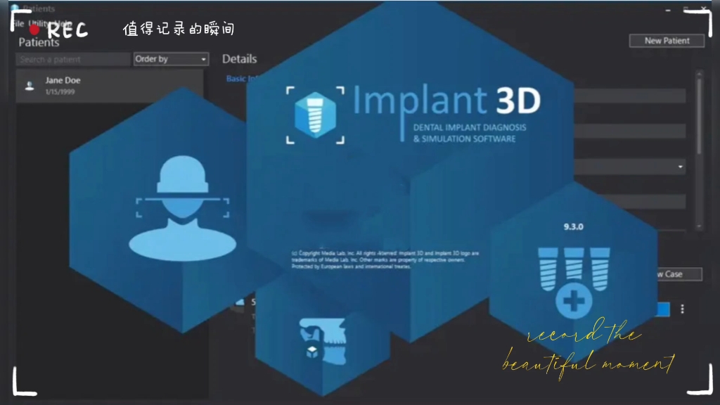 Implant3D 9.3 激活版高级牙科种植体规划模拟软件