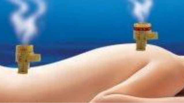 艾灸探秘:艾灸常用辅助工具一览