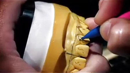 DSD数码微笑设计课程(前牙美学修复设计)3