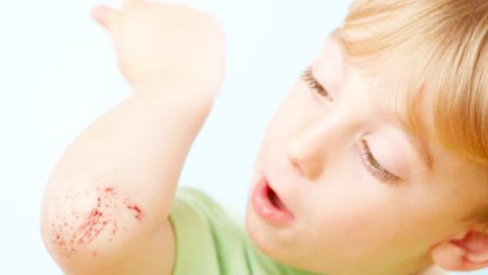 擦伤的即时处理办法,不用碘伏一样可以杀菌消毒哦