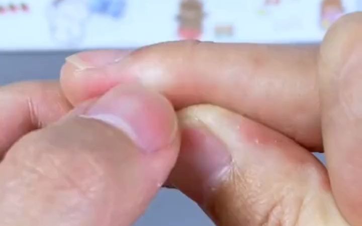 ...上三年级,手上全是写字留下的泡和老茧,赶紧给孩子安排这个 护指绷带