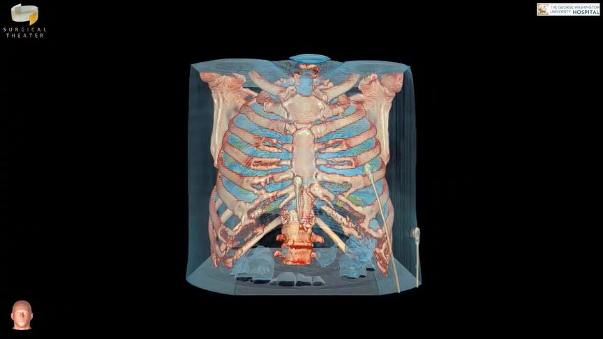 透视VR告诉你,新冠病毒是如何感染肺部的?戳视频了解→