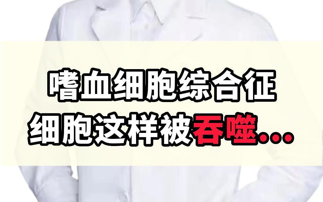 嗜血细胞综合征,骨穿结果原来是这样子,孩子的正常细胞就这样被吞噬...