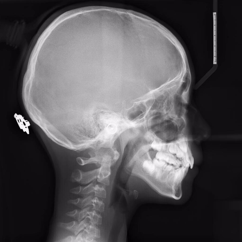 数字化口腔正畸 
